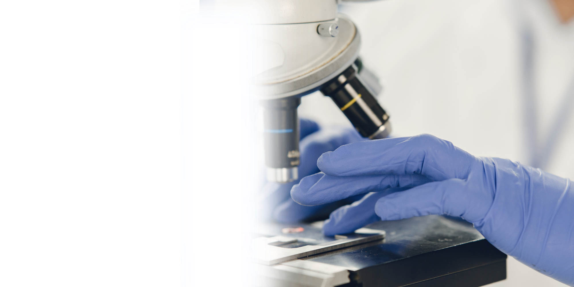 Ovarian Reserve Testing | Manchester Fertility